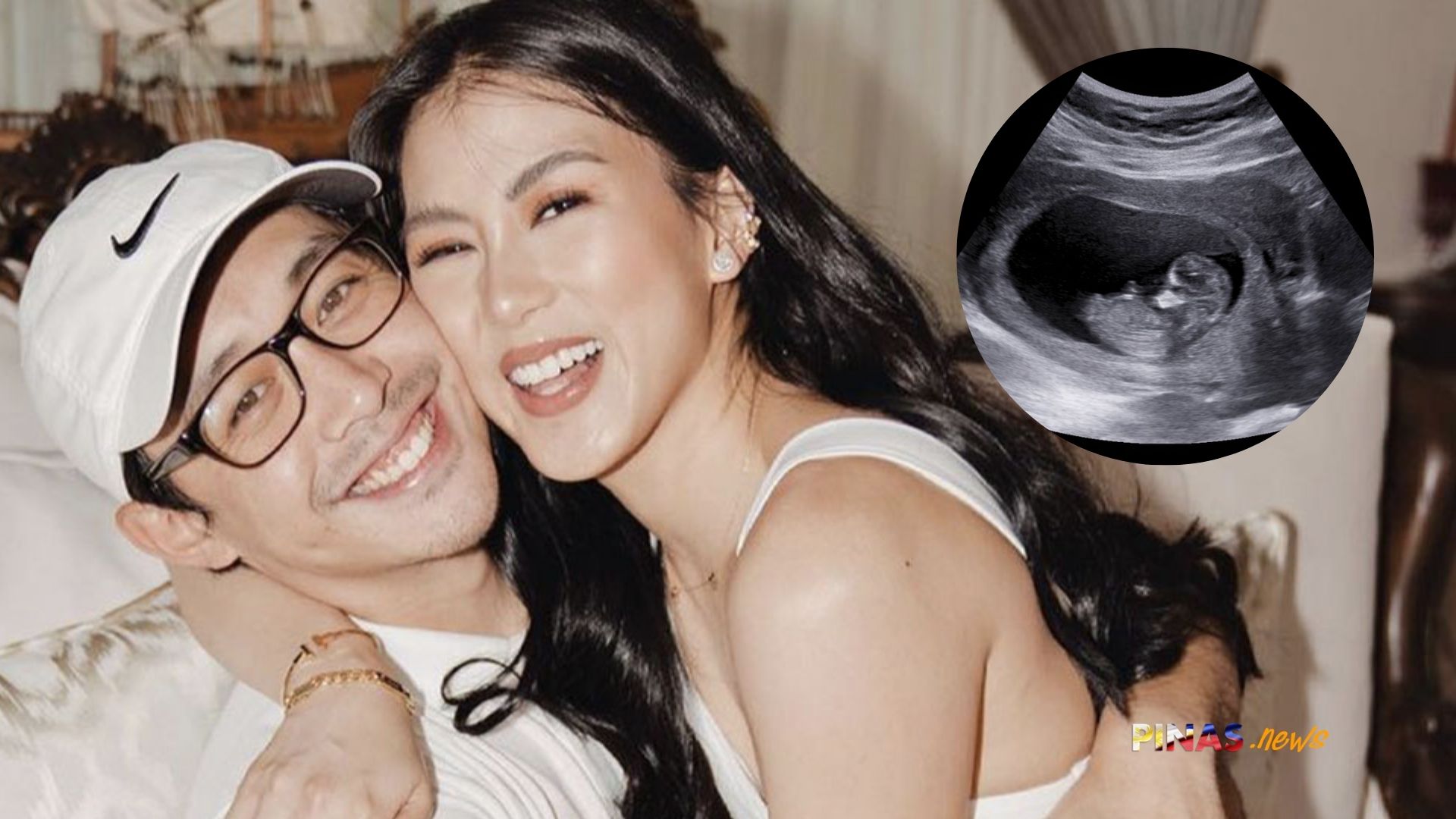 Ikatlong Pagkakunan ni Alex Gonzaga, Mikee Morada mas ipinakita ang pag mamahal at suporta sa asawa